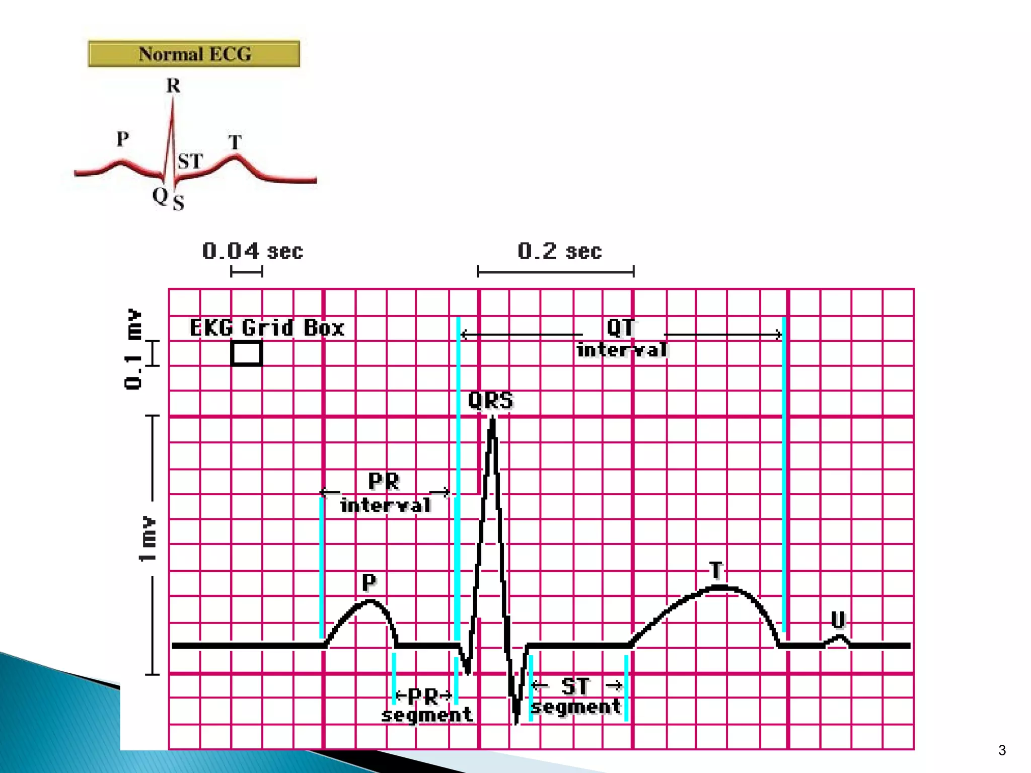 Dasar dasar ekg fix | PPT