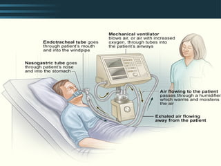 Dasar-dasar ventilator mekanik - The Basic of Mechanic Ventilator | PPTX