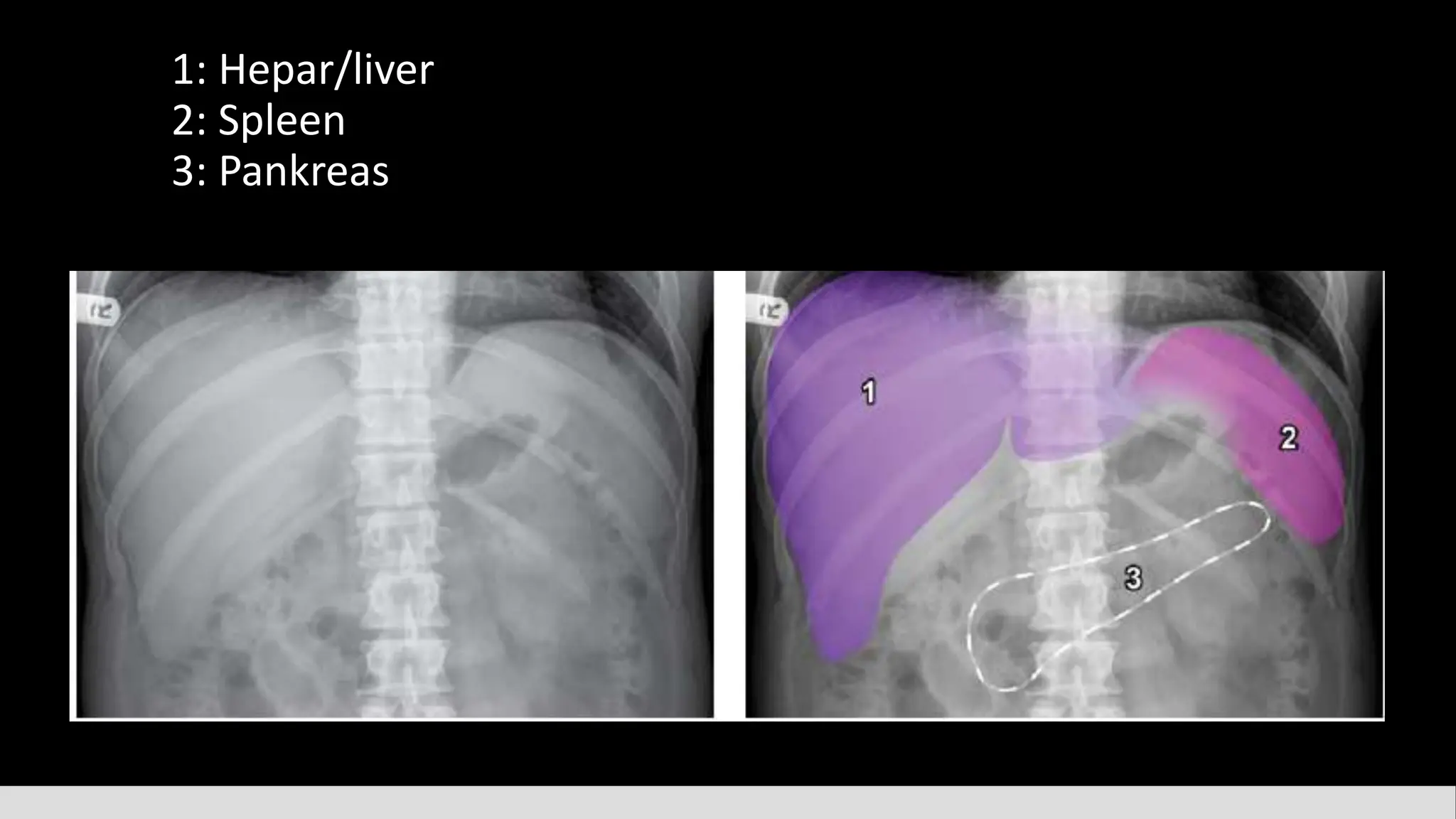 Prinsip dasar Dasar Pembacaan Abdomen manusia | PPT | Free Download