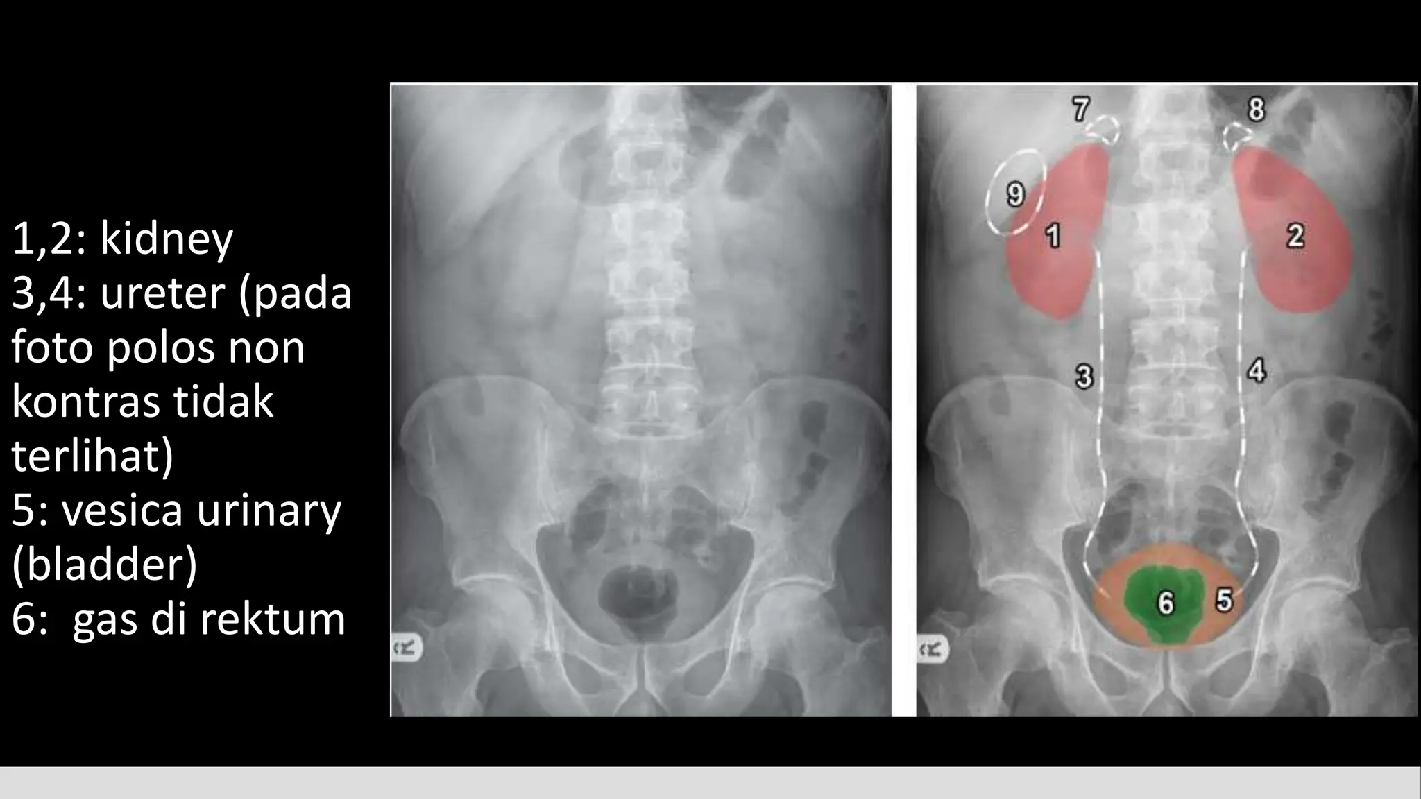 Prinsip dasar Dasar Pembacaan Abdomen manusia | PPT
