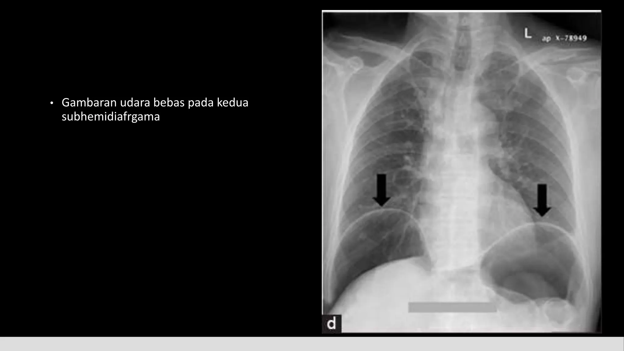 Prinsip dasar Dasar Pembacaan Abdomen manusia | PPT