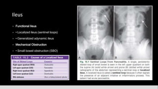 Prinsip dasar Dasar Pembacaan Abdomen manusia | PPT