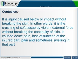 Prevention and management of sports injury | PPT