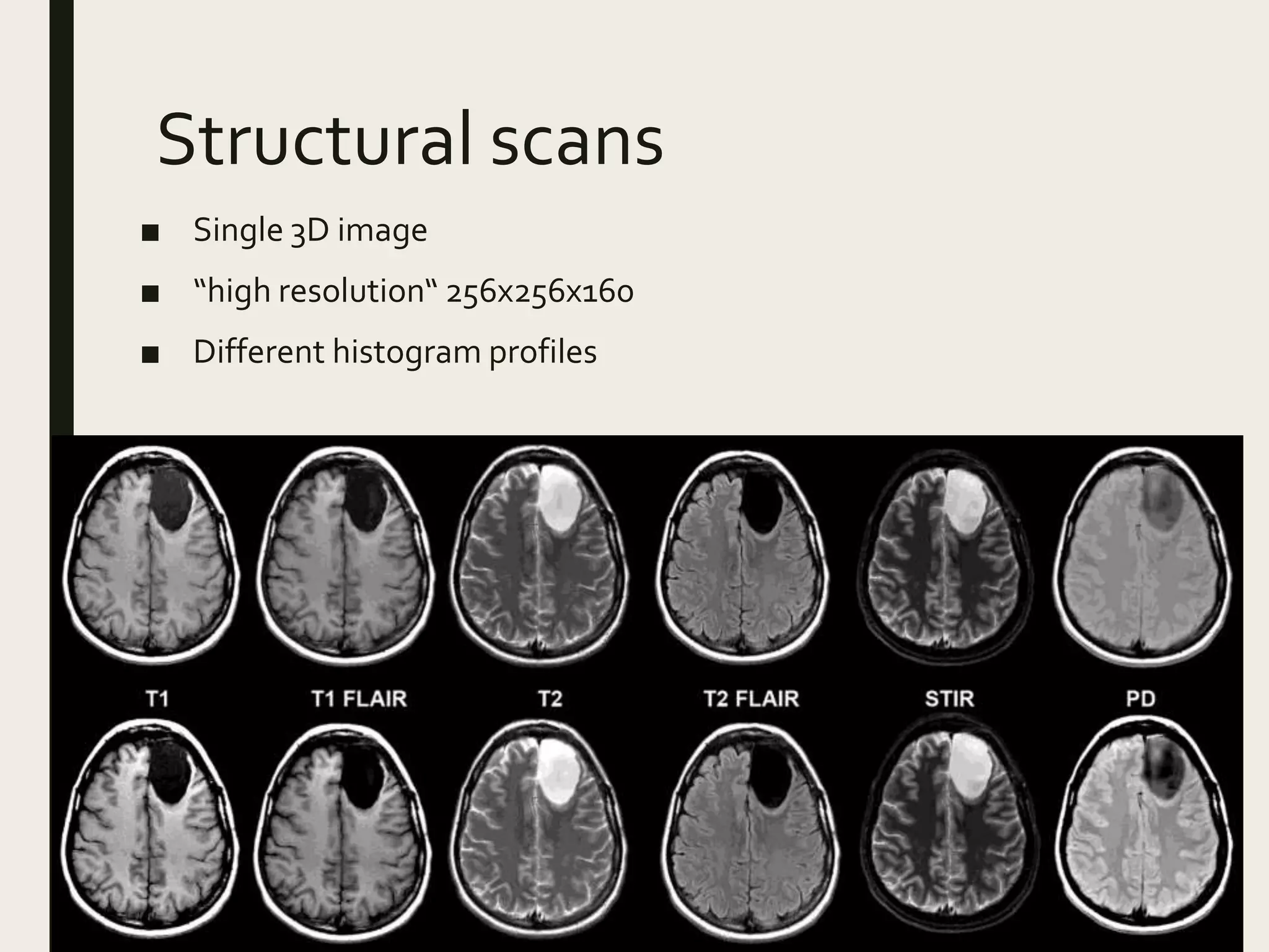 Ml Researchers Guide To Open Brain Imaging Data Ppt