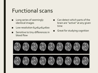 ML Researcher’s Guide to Open Brain Imaging Data | PPT