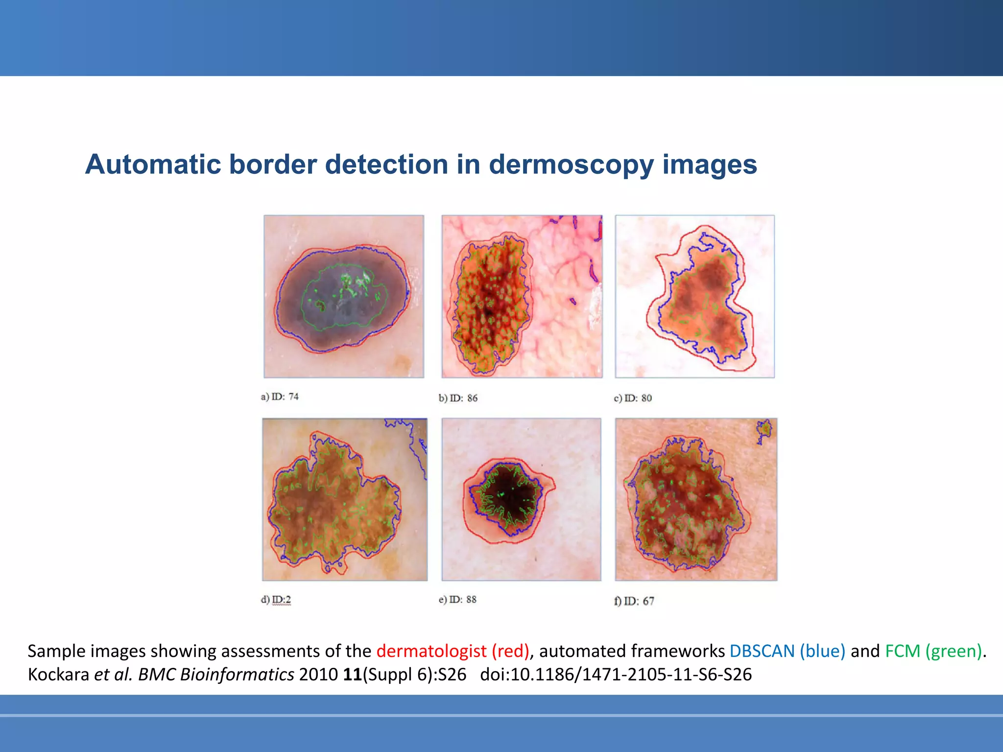 Density Based Clustering Ppt
