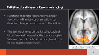 Data mining in fmri data | PPT