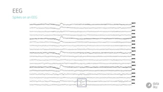 Machine learning and Internet of Things, the future of medical ...