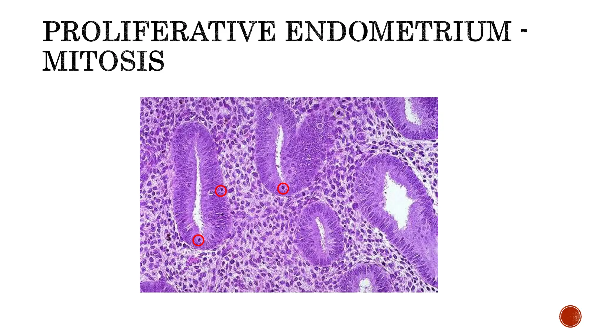 DATING OF ENDOMETRIUM - female genital tract.pptx