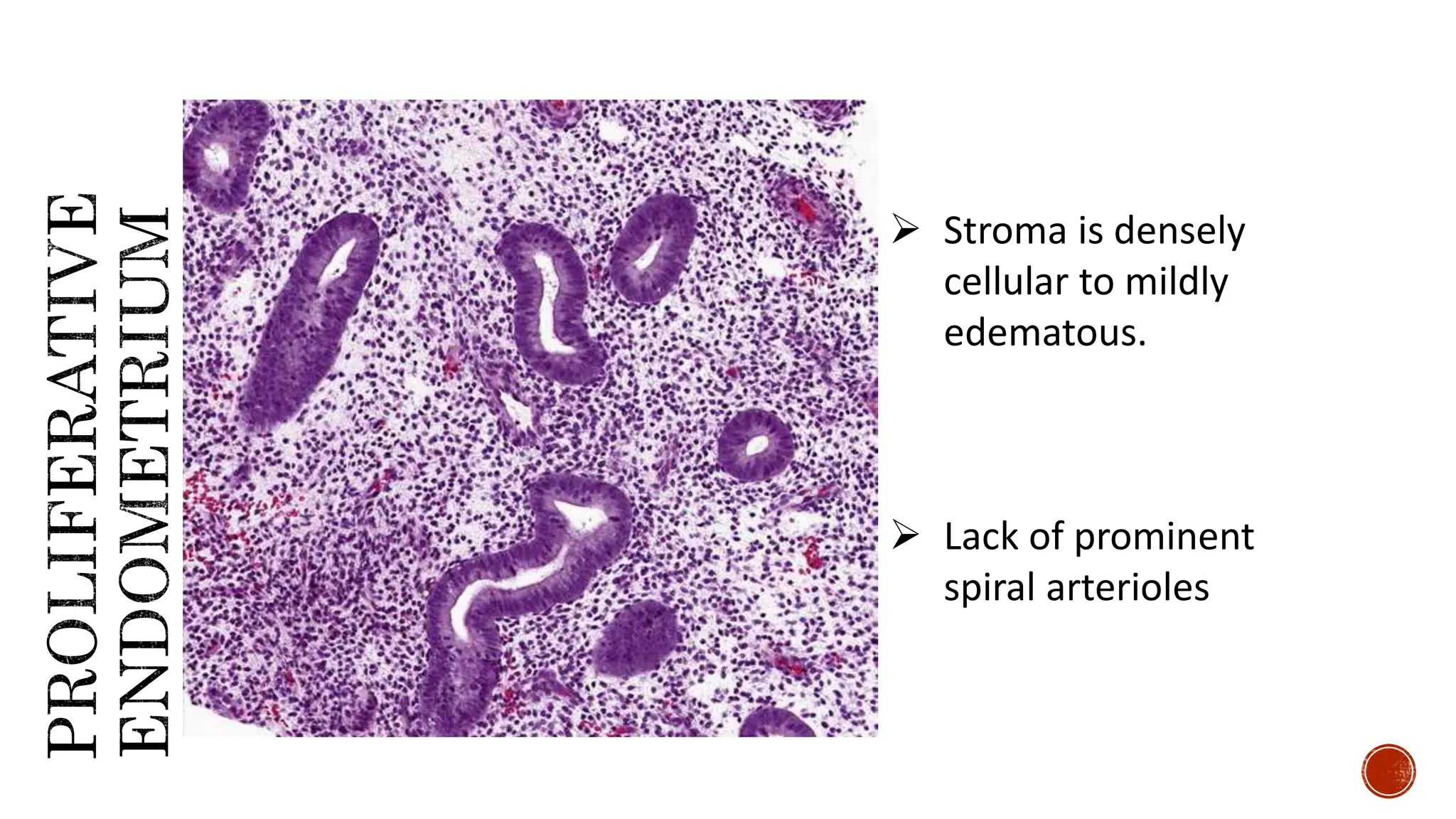 DATING OF ENDOMETRIUM - female genital tract.pptx
