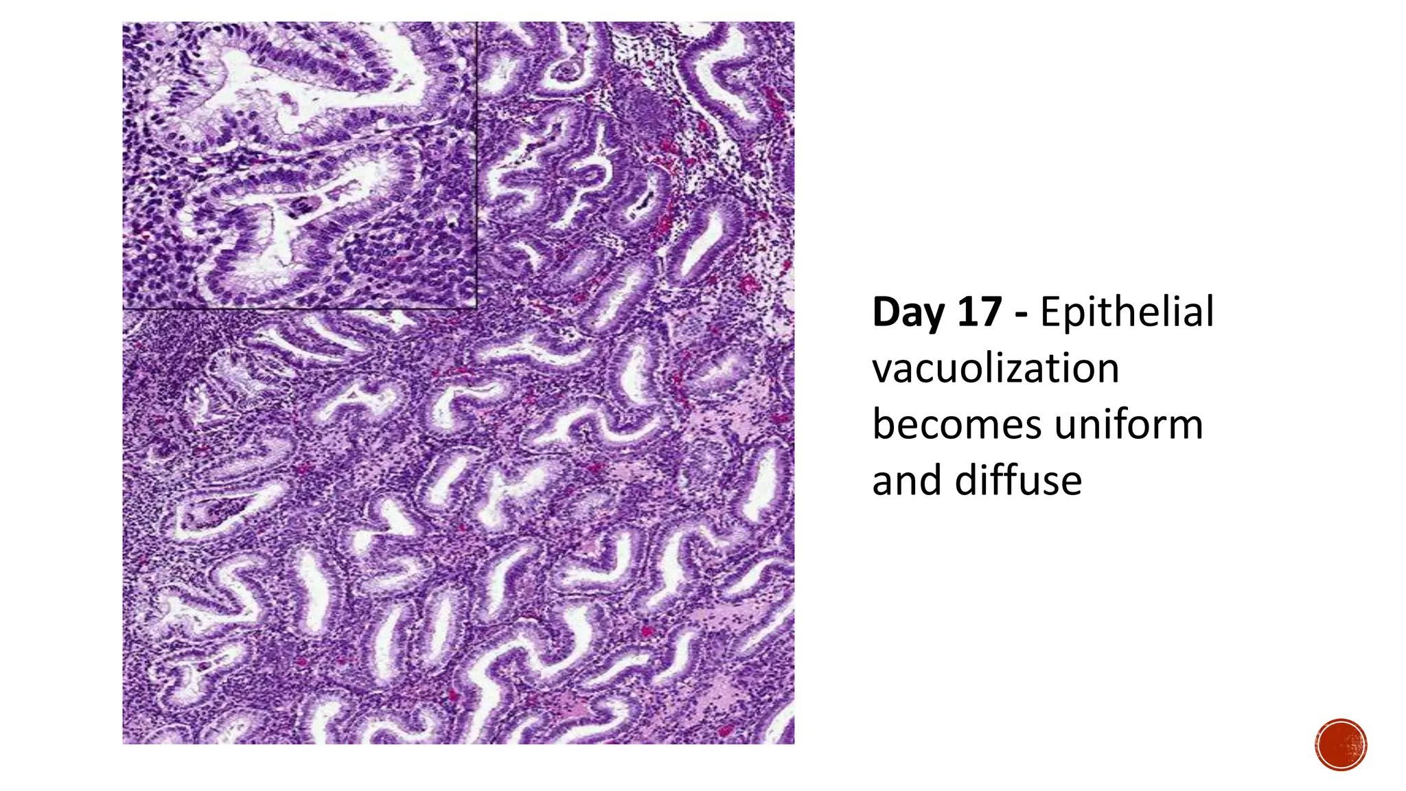 DATING OF ENDOMETRIUM - female genital tract.pptx