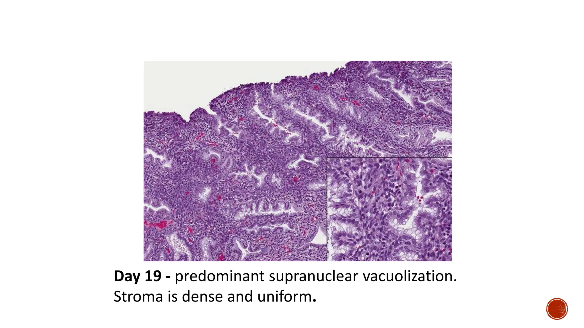 DATING OF ENDOMETRIUM - female genital tract.pptx