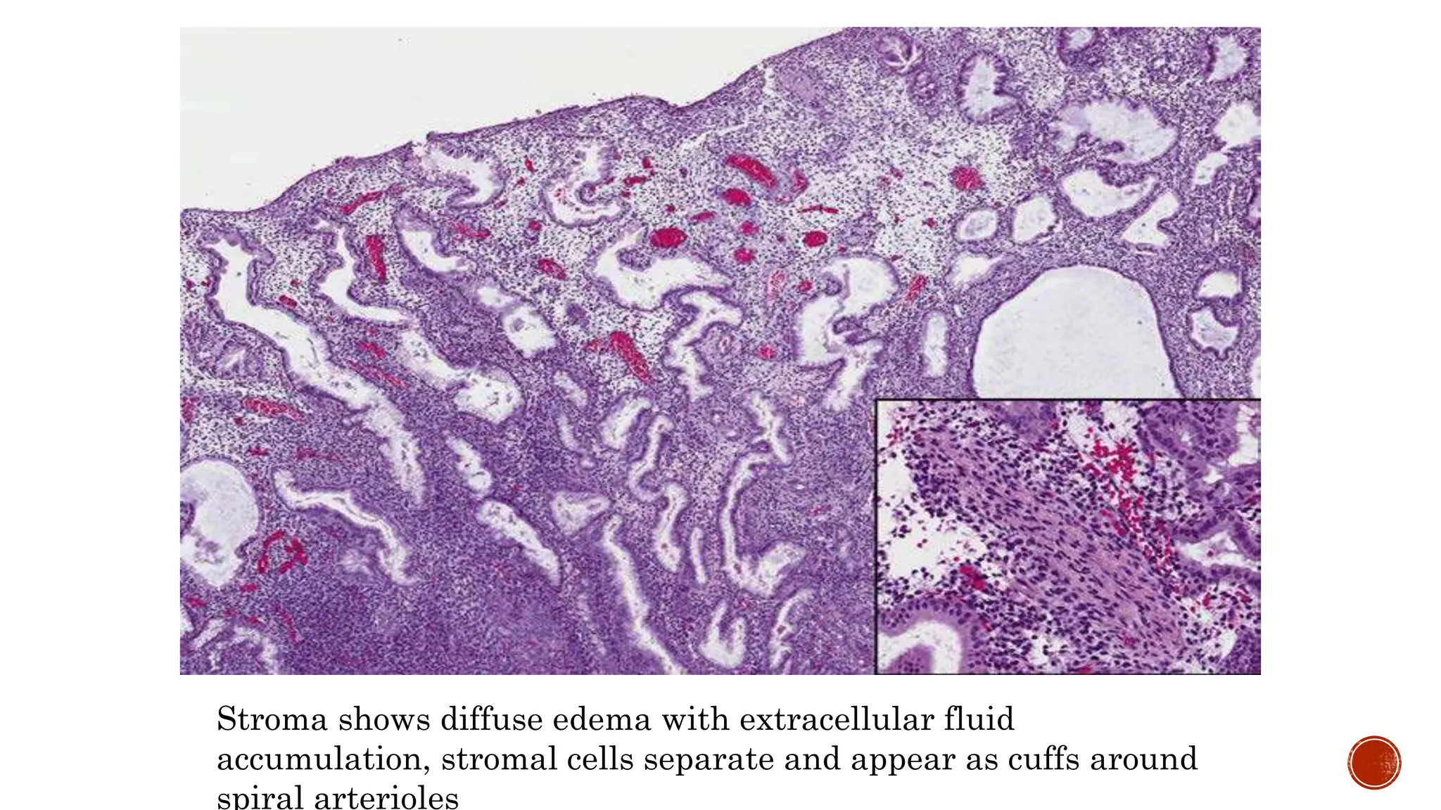 DATING OF ENDOMETRIUM - female genital tract.pptx