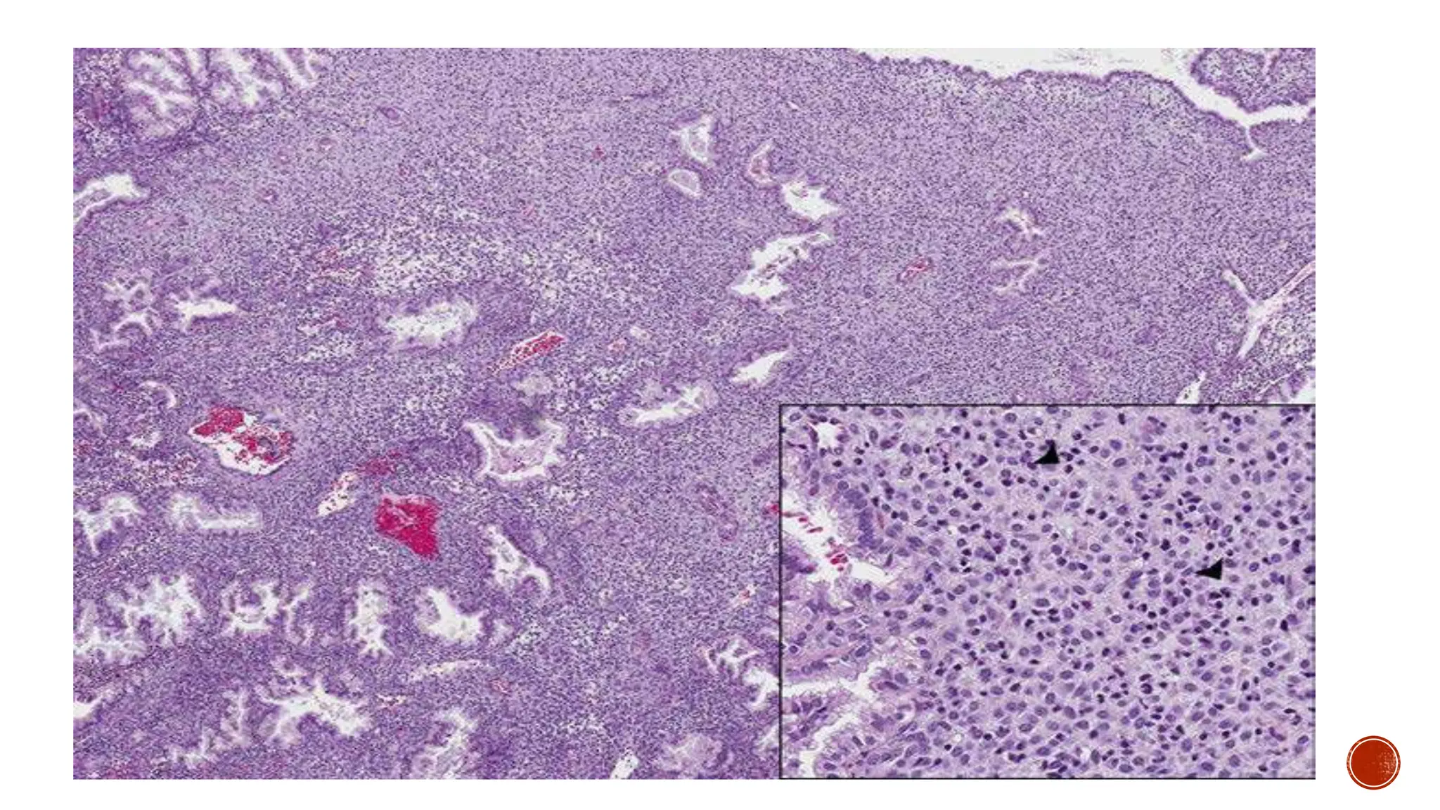 DATING OF ENDOMETRIUM - female genital tract.pptx