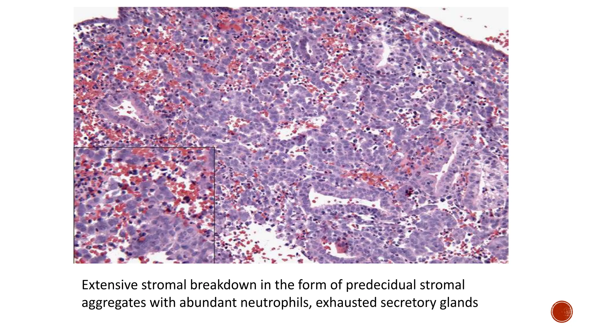 DATING OF ENDOMETRIUM - female genital tract.pptx