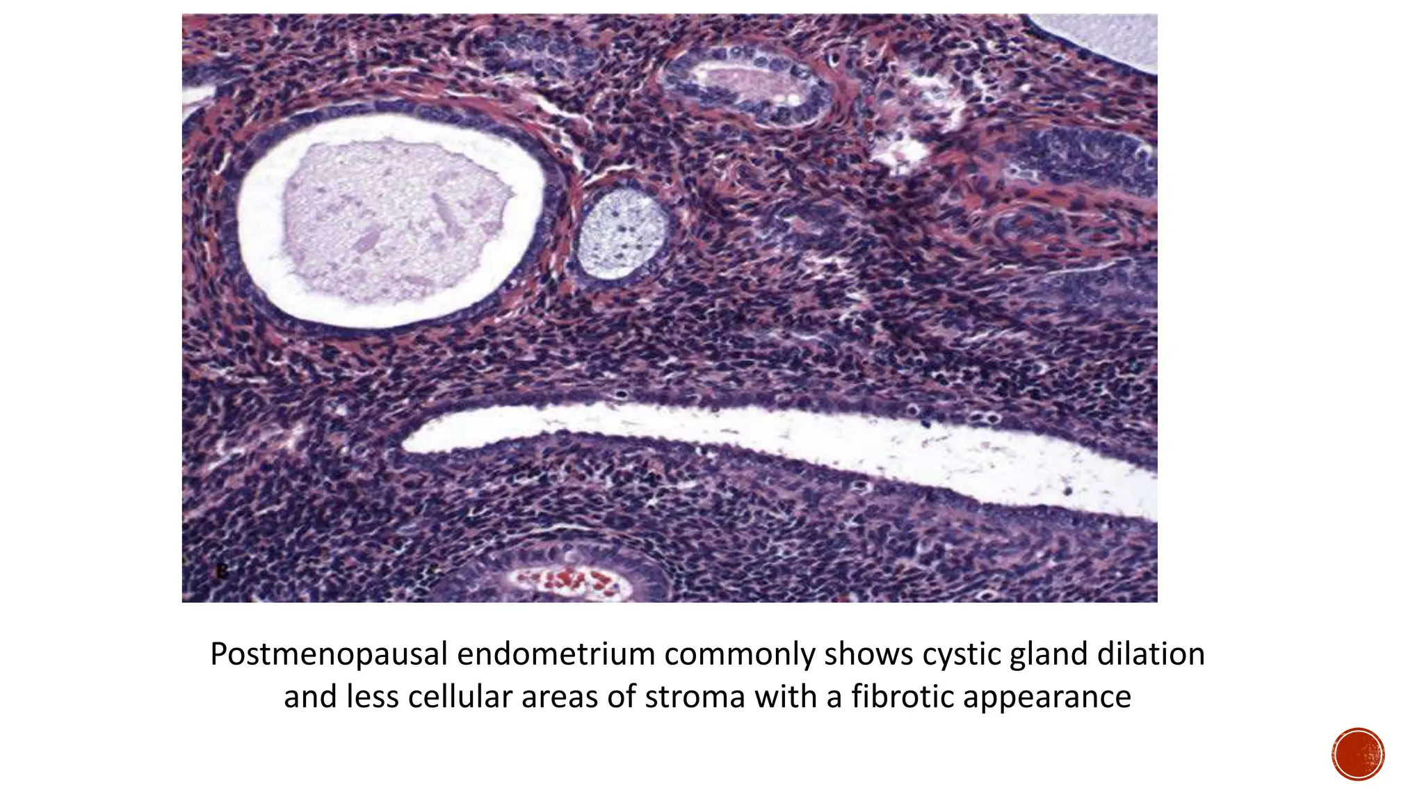 DATING OF ENDOMETRIUM - female genital tract.pptx