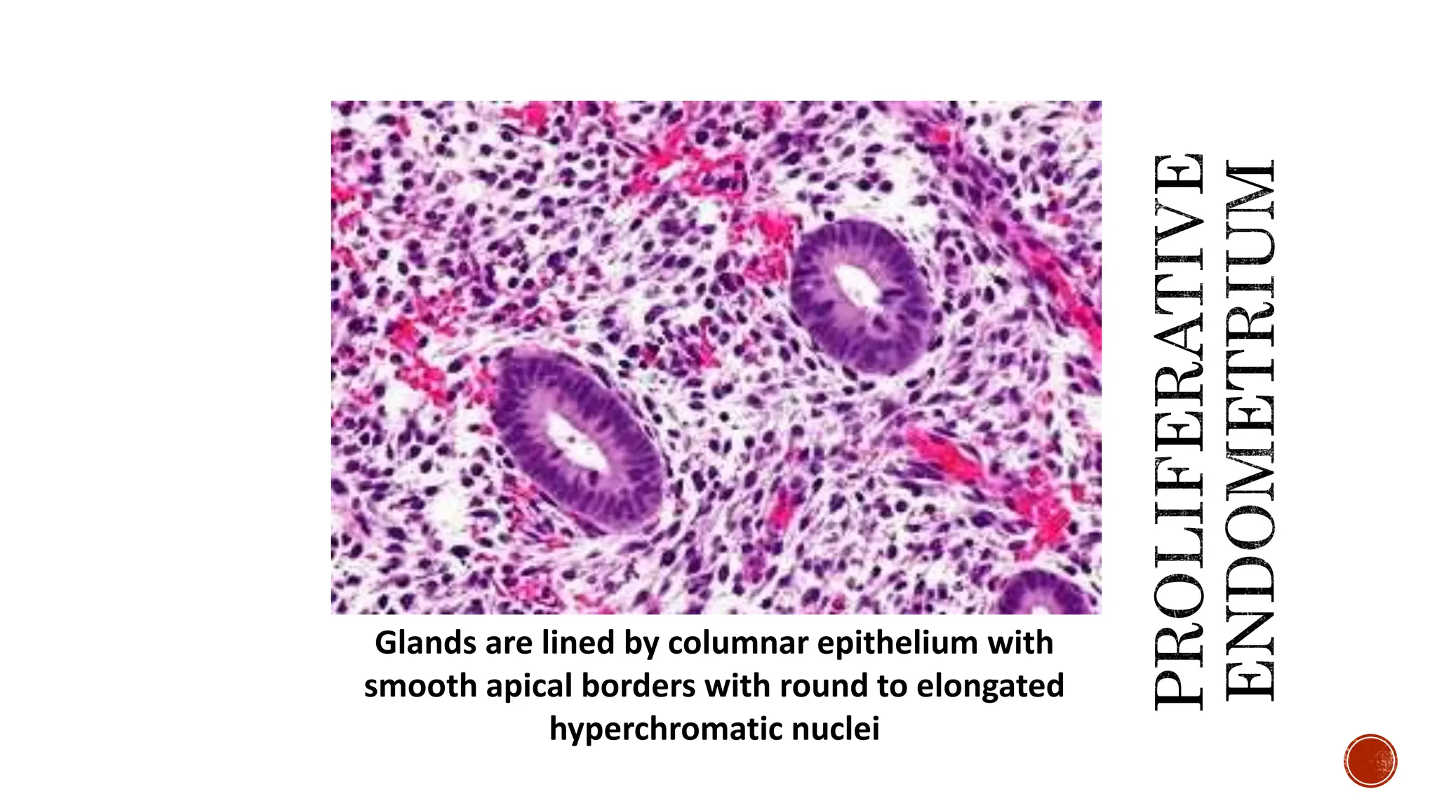 DATING OF ENDOMETRIUM - female genital tract.pptx