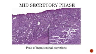 DATING OF ENDOMETRIUM - female genital tract.pptx