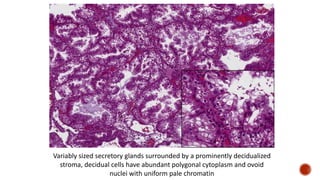 DATING OF ENDOMETRIUM - female genital tract.pptx