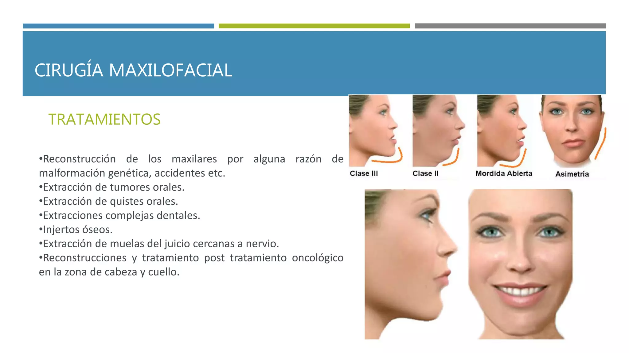Datos sobre la cirugia maxilofacial | PPT