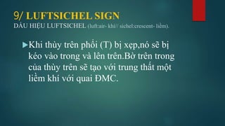 Dau hieu x quang ngực (signsinchestxray) | PDF