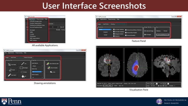 The Cancer imaging Phenomics Toolkit (CaPTk) | PPT