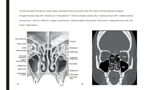 ANATOMY of the bone and nasal cavity anatomy | PPT