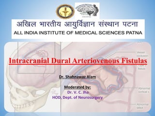 Dural arteriovenous fistula | PPTX