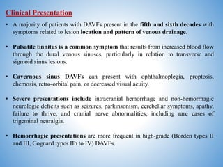 Dural arteriovenous fistula | PPTX