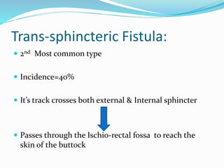 Anal fistula AND Anal fissure | PPTX