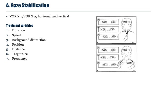Vestibular and balance disorders in MS