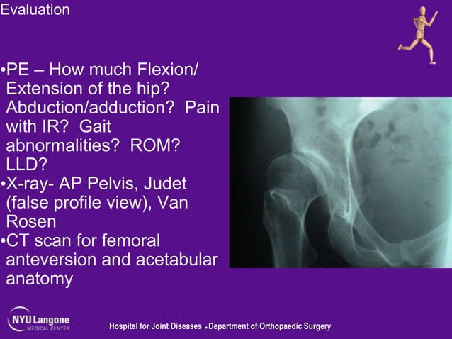 The Hip Joint in Cerebral Palsy | David S. Feldman, MD | PPT