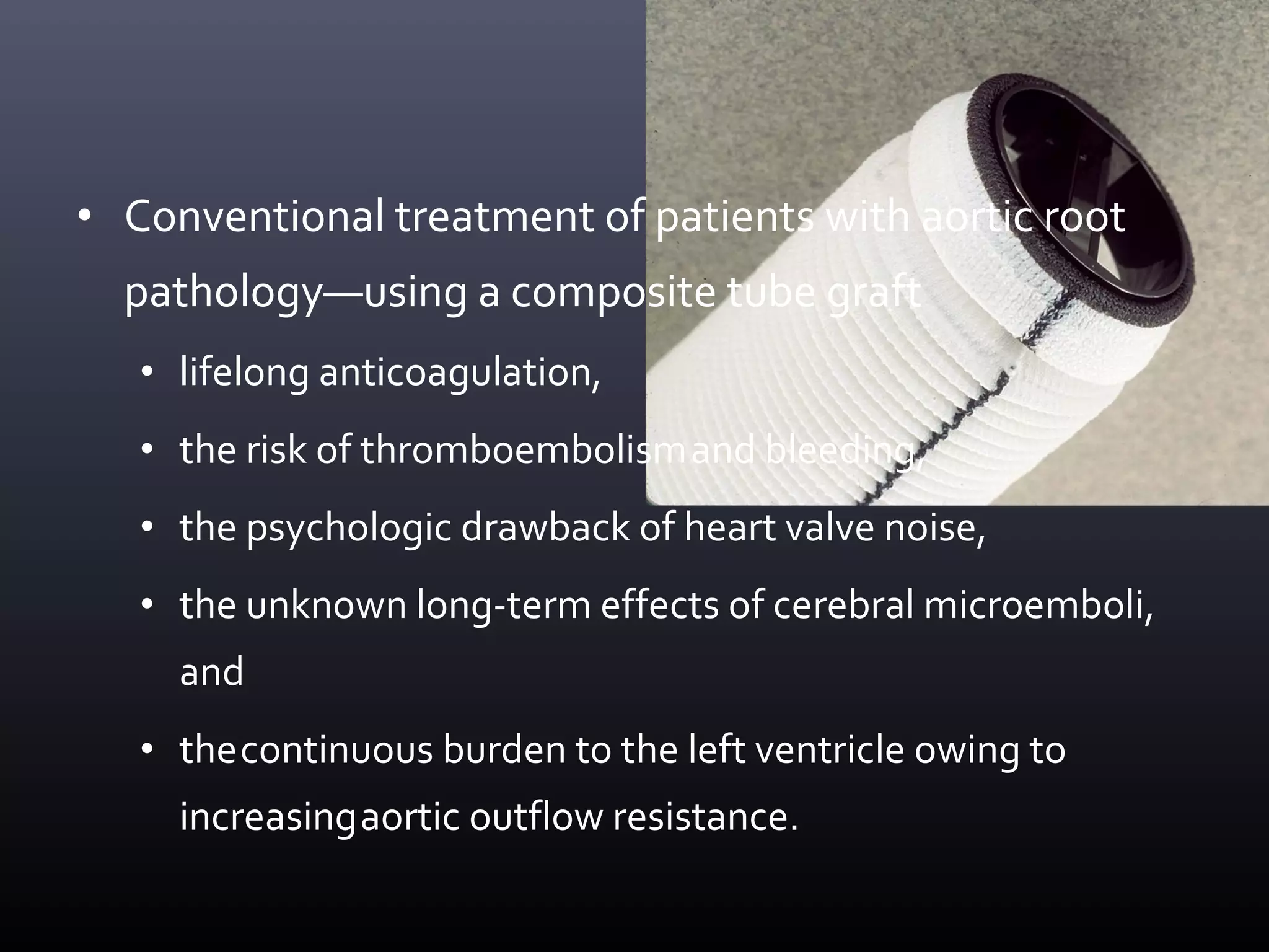 Aortic Valve Sparring Root Replacement | PPT