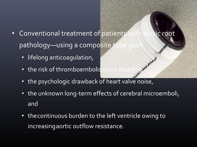 Aortic Valve Sparring Root Replacement | PPT