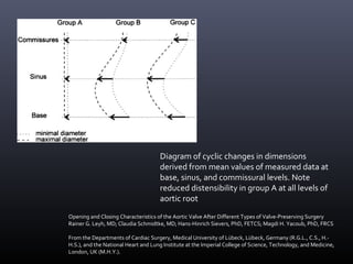 Aortic Valve Sparring Root Replacement David vs yacoub | PPT