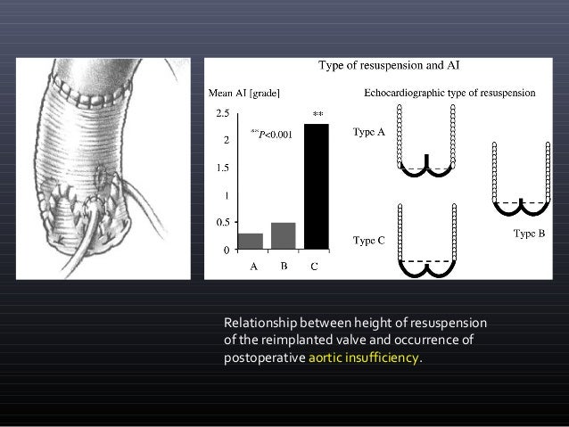 Aortic Valve Sparring Root Replacement David vs yacoub
