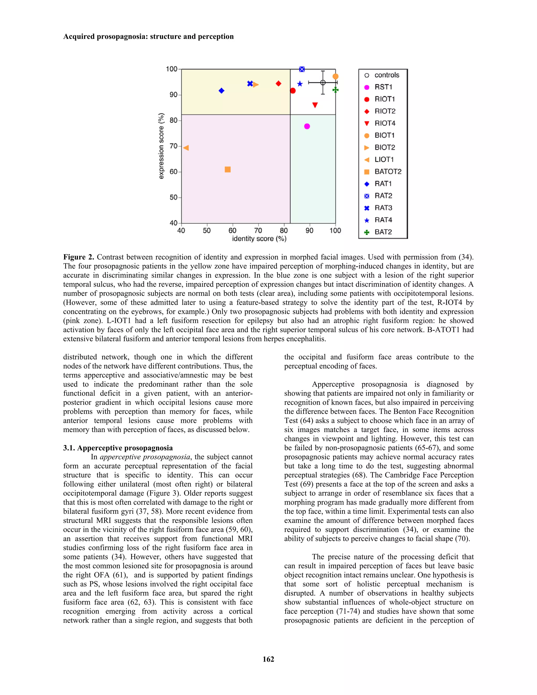 Acquired prosopagnosia: structural basis and processing impairments. | PDF
