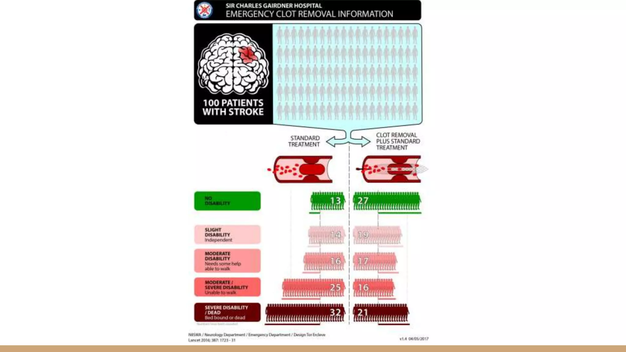 Thrombectomy in Stroke: DAWN and DEFUSE3 trial data | PPTX