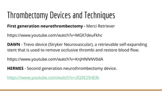 Thrombectomy in Stroke: DAWN and DEFUSE3 trial data | PPTX