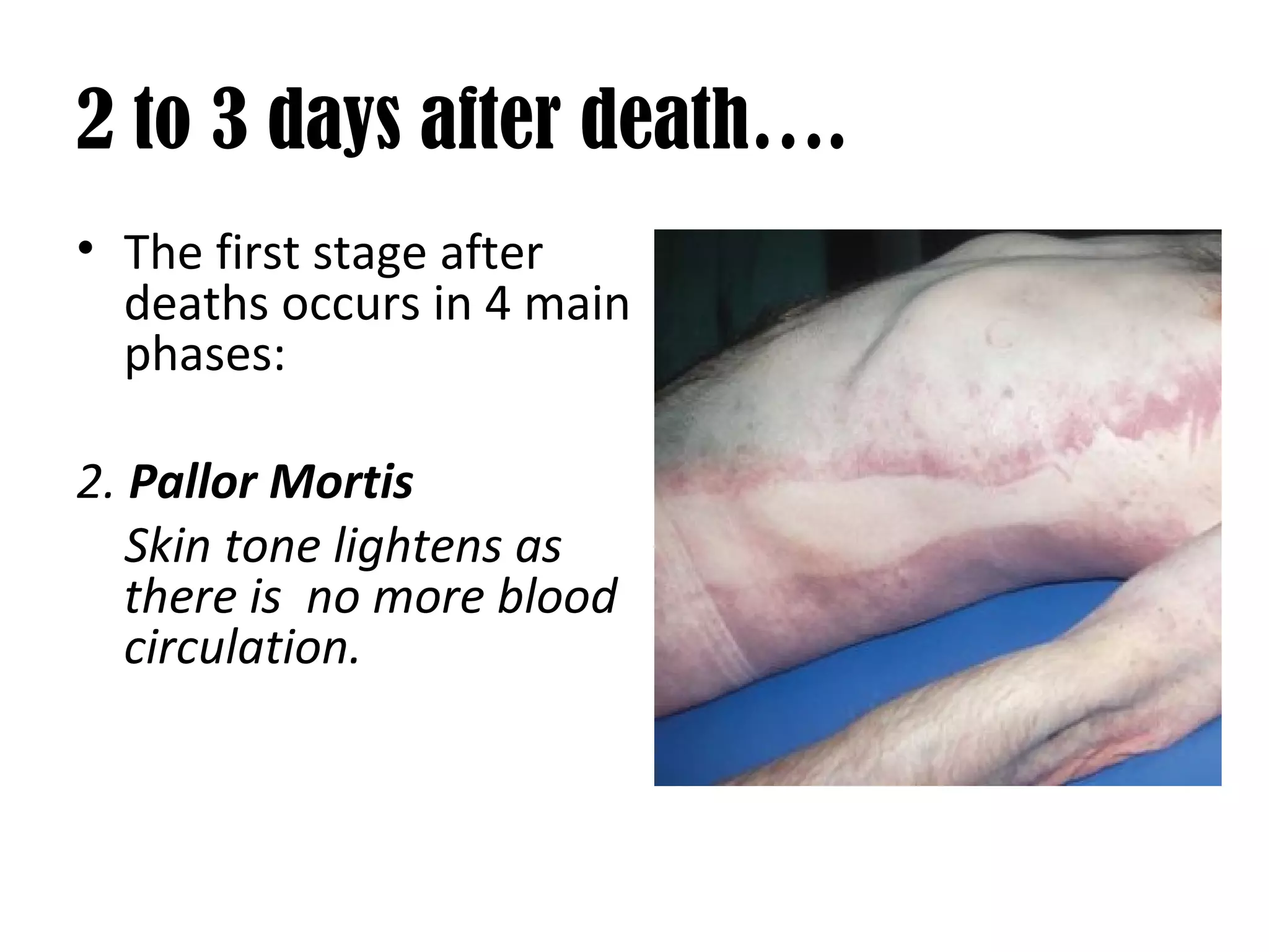 Day 2 the science of death | PPT