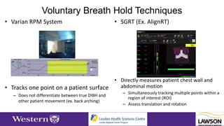 SBRT: The Importance of Continuous Motion Management | PPTX