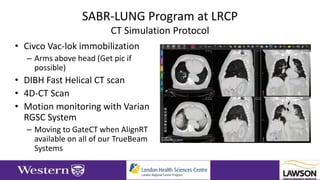 SBRT: The Importance of Continuous Motion Management | PPTX