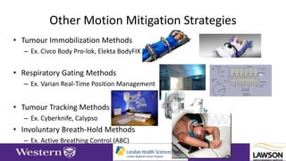 SBRT: The Importance of Continuous Motion Management | PPTX