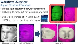 IGRT + SGRT for Confident and Efficient SRS | PPTX