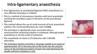 anesthesia in children and their types and indications and contra ...