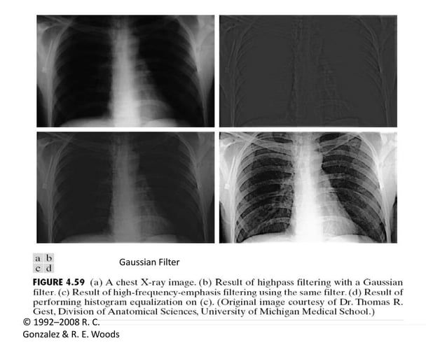DIGITAL IMAGE PROCESSING - Day 4 Image Transform | PDF | Digital Audio ...