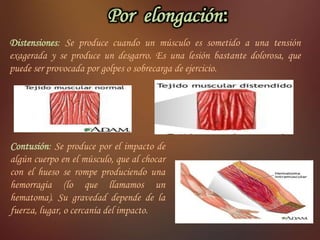 lesiones oseas articulares y musculares | PPTX
