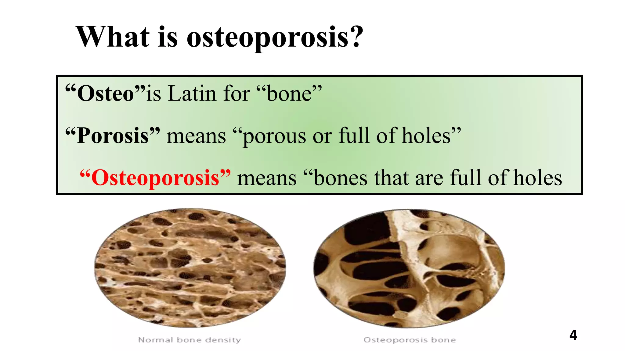 Secondary Osteoporosis Presentation | PPTX