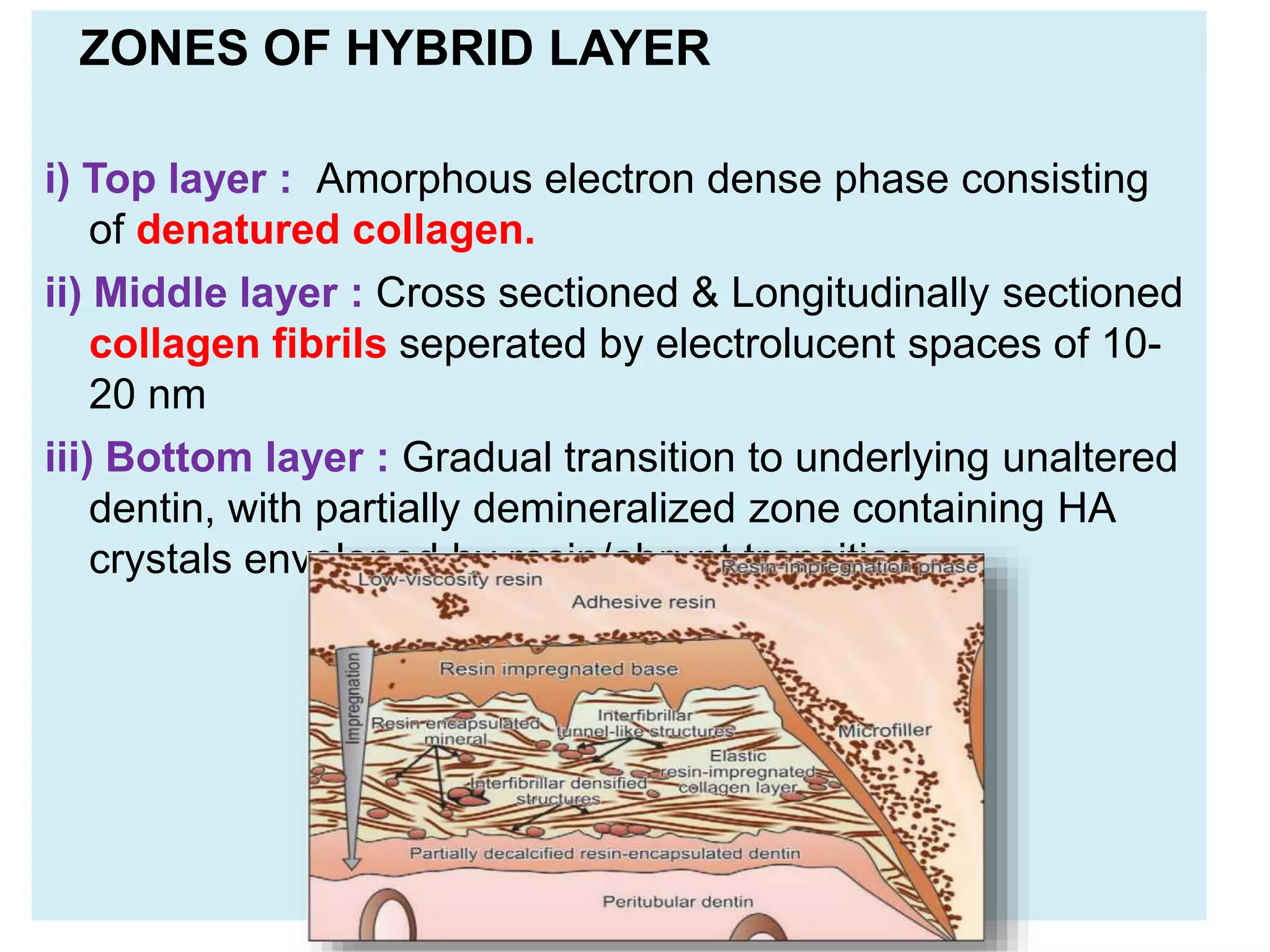 DENTIN BONDING AGENTS | PPTX