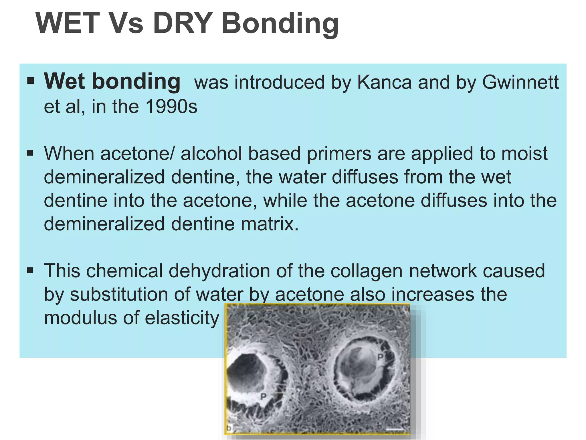 DENTIN BONDING AGENTS | PPTX
